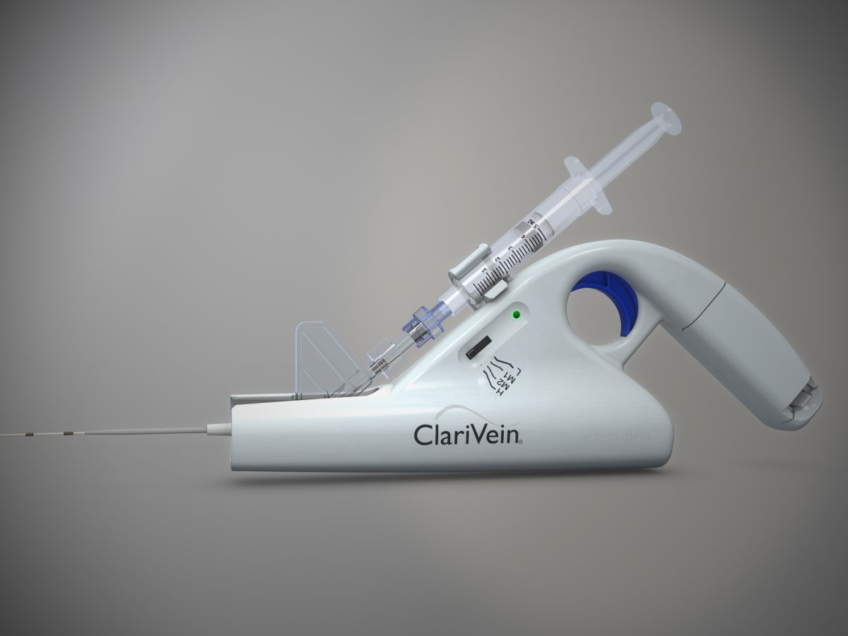 ClariVein (léčba křečových žil), Varixy (křečové žíly ...